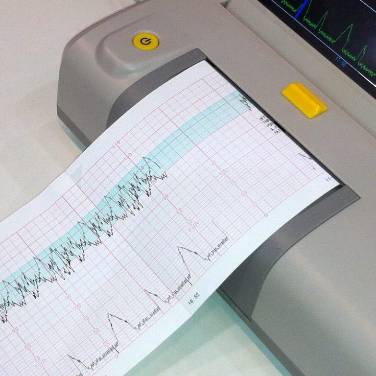 EasyTrace ® High Quality Fetal Monitoring Papers